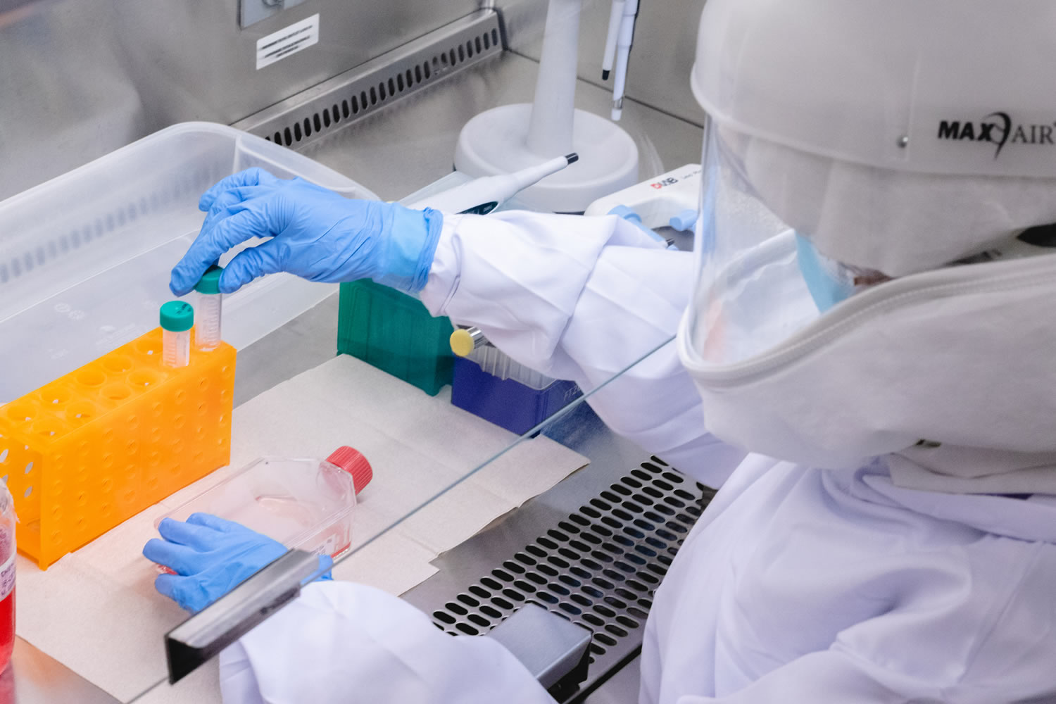 Investigadores de la UdeA lograron aislar el virus de la viruela símica Investigadores de la UdeA lograron aislar el virus de la viruela símica