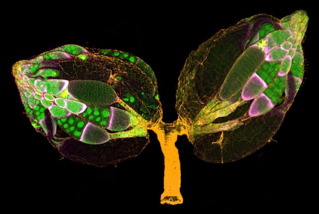 Conoce algunas de las mejores Imágenes del mundo microscópico 2019